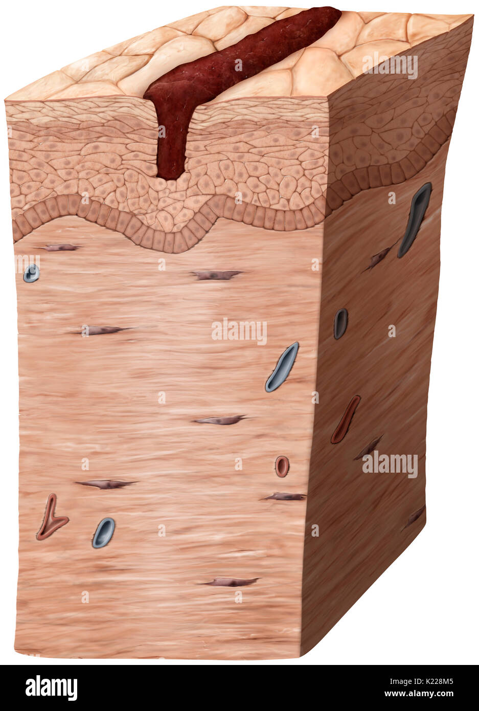 Scab scar hi-res stock photography and images - Alamy