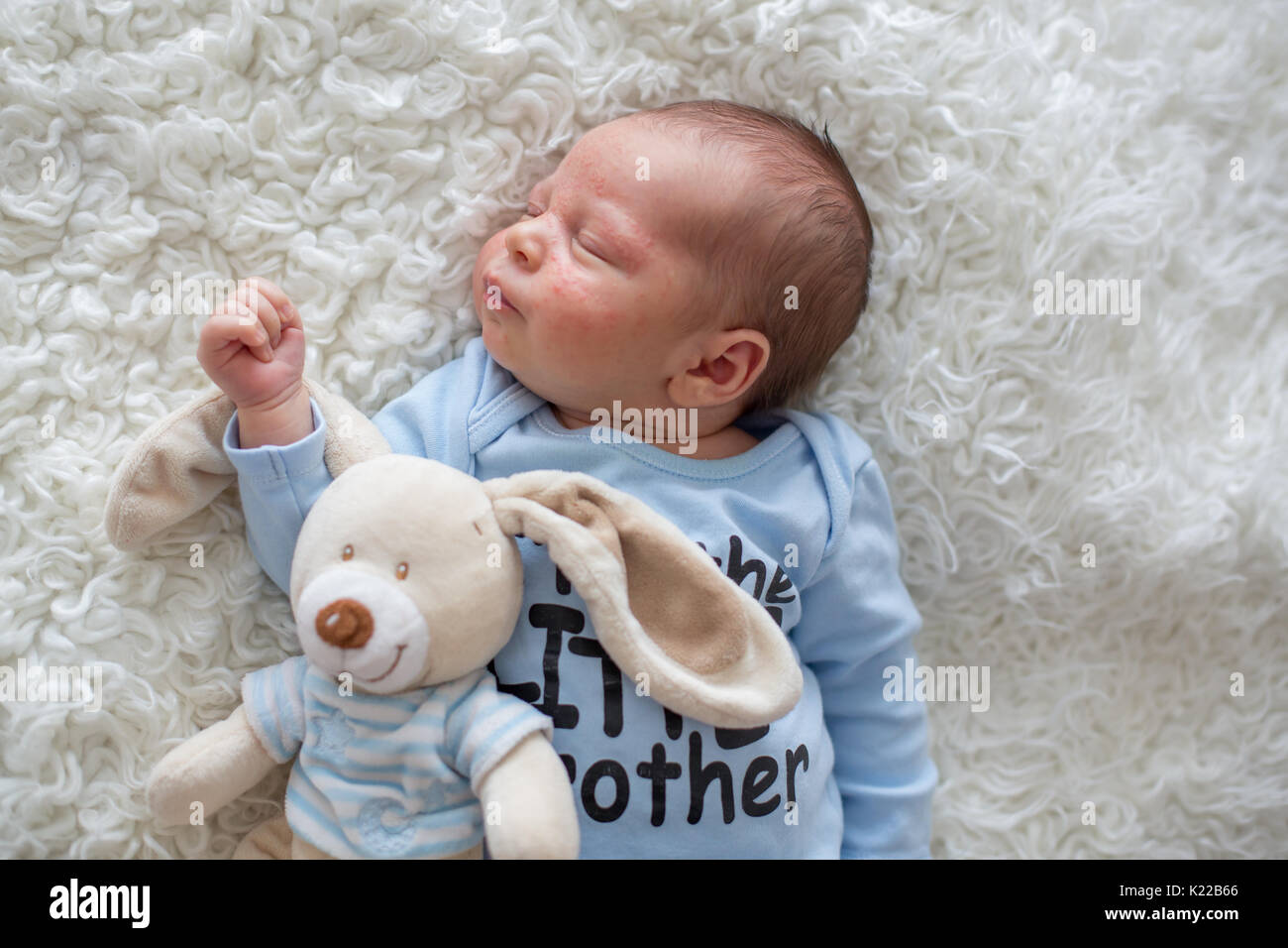 Little newborn baby sleeping with toy, baby with scin rash, child ...