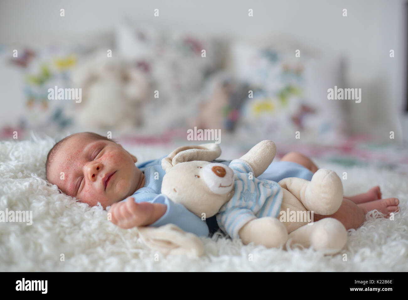 Little newborn baby sleeping with toy, baby with scin rash, child ...