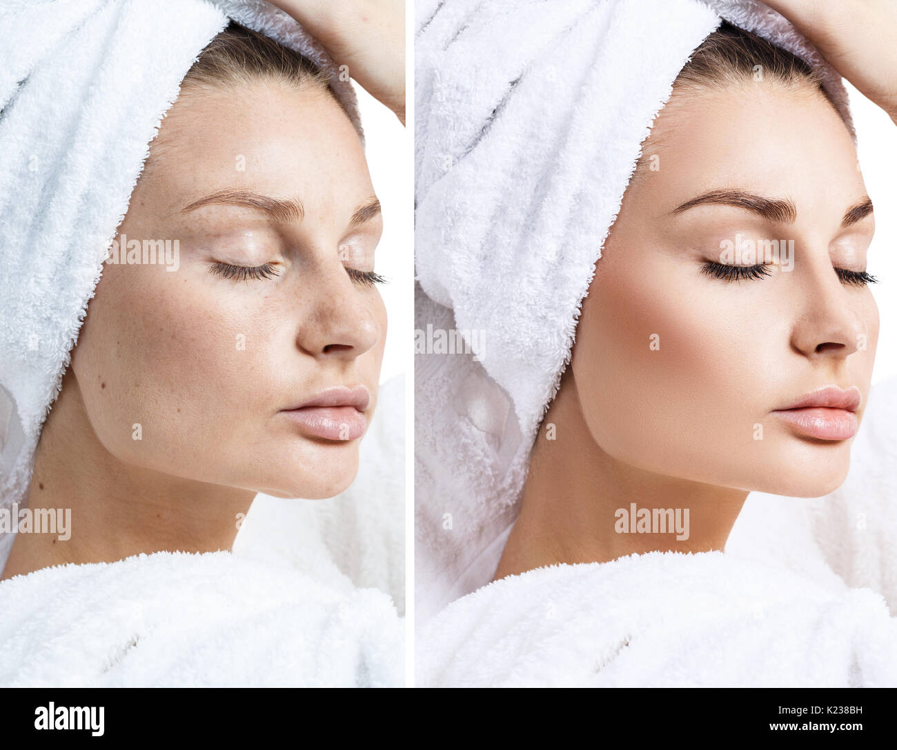 Young woman before and after retouch Stock Photo - Alamy