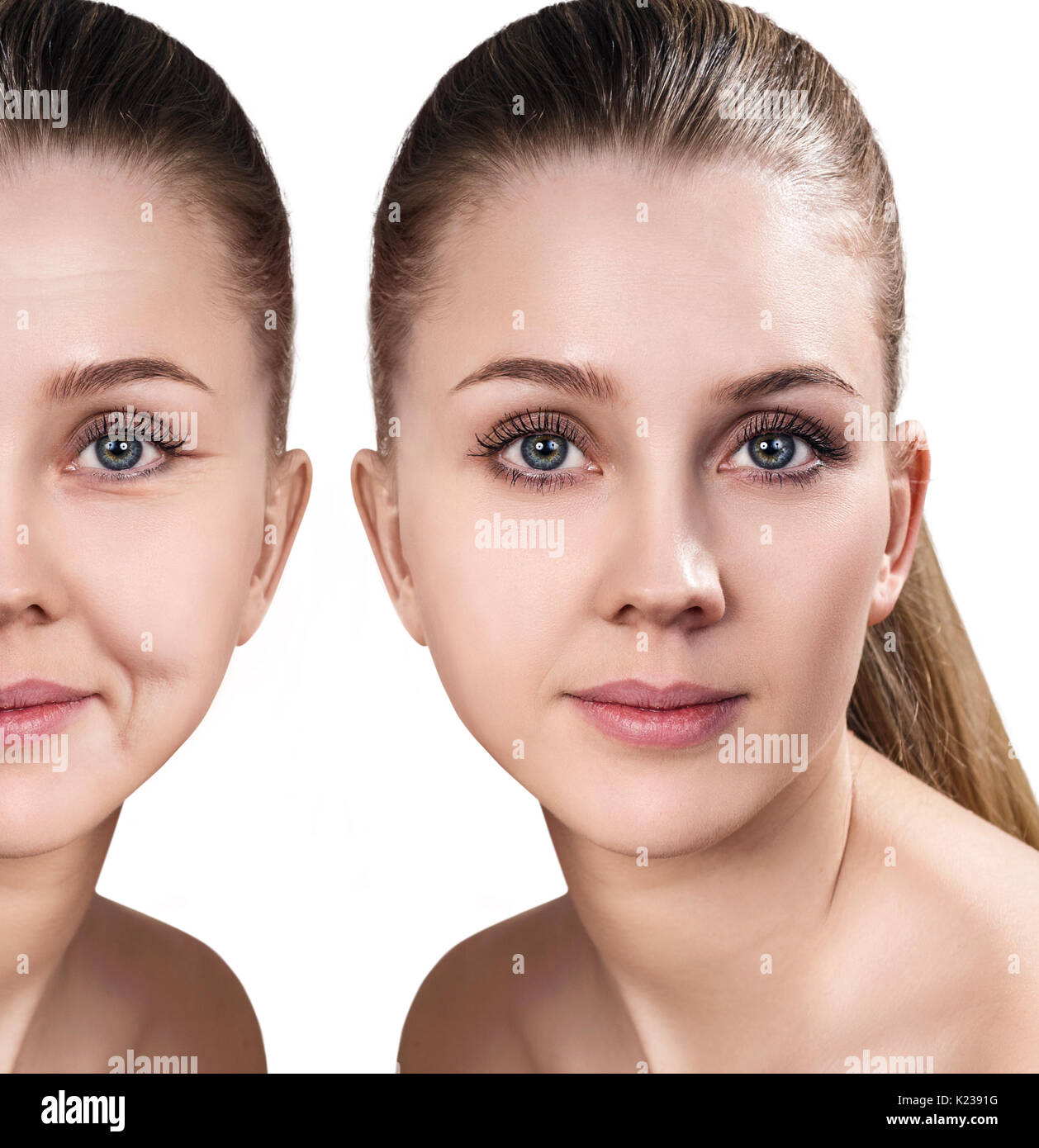 Woman's face before and after rejuvenation Stock Photo - Alamy
