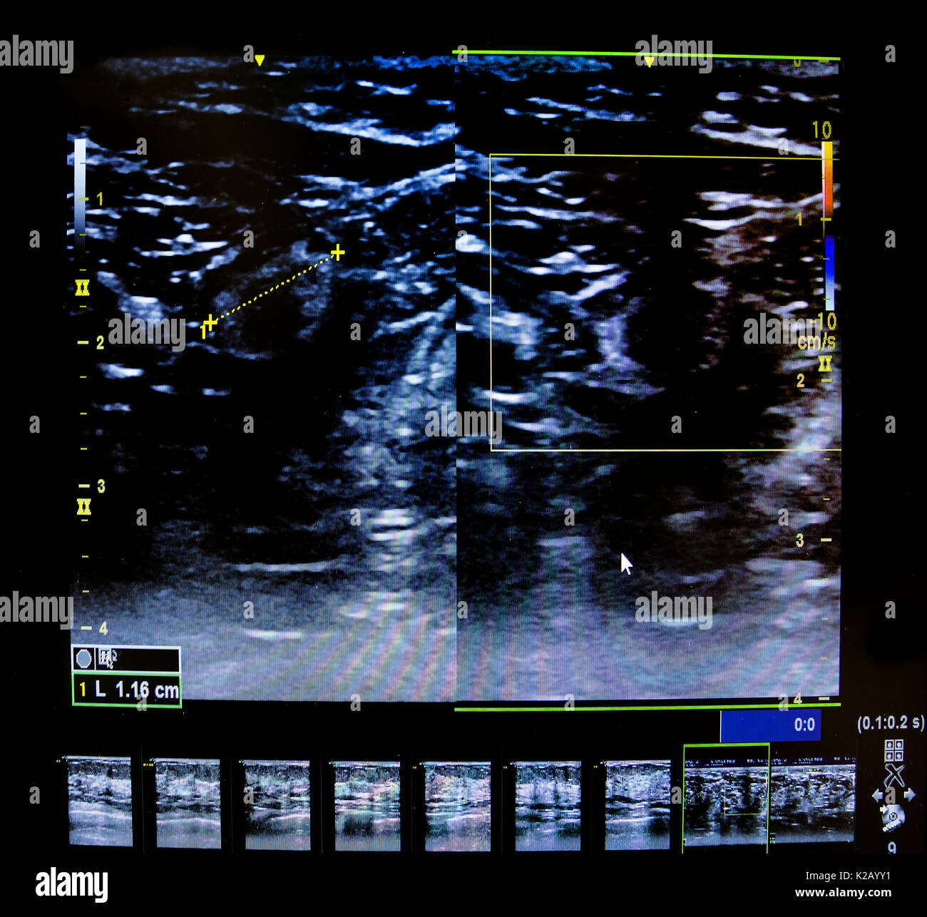 Modern medical imaging hi-res stock photography and images - Alamy