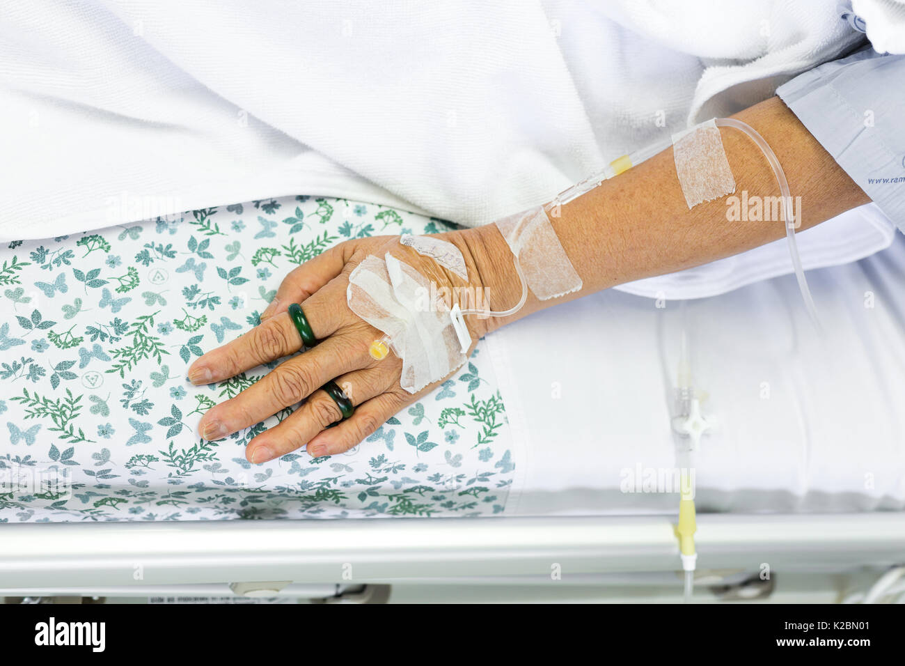 Tube of saline solution stick on patient hand to treatment Stock Photo ...