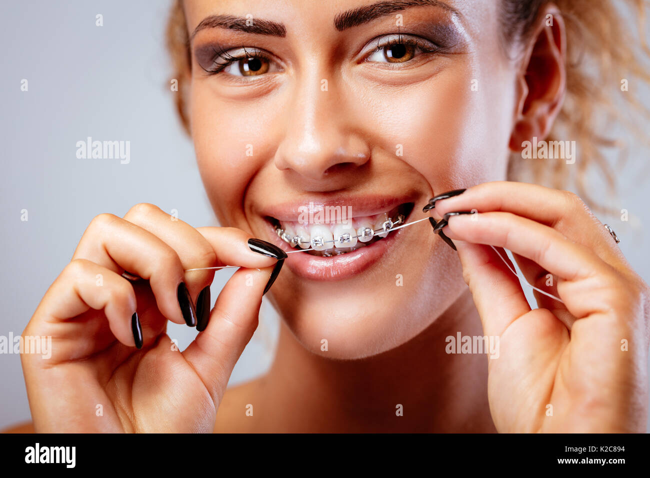 Girl with braces hi-res stock photography and images - Alamy