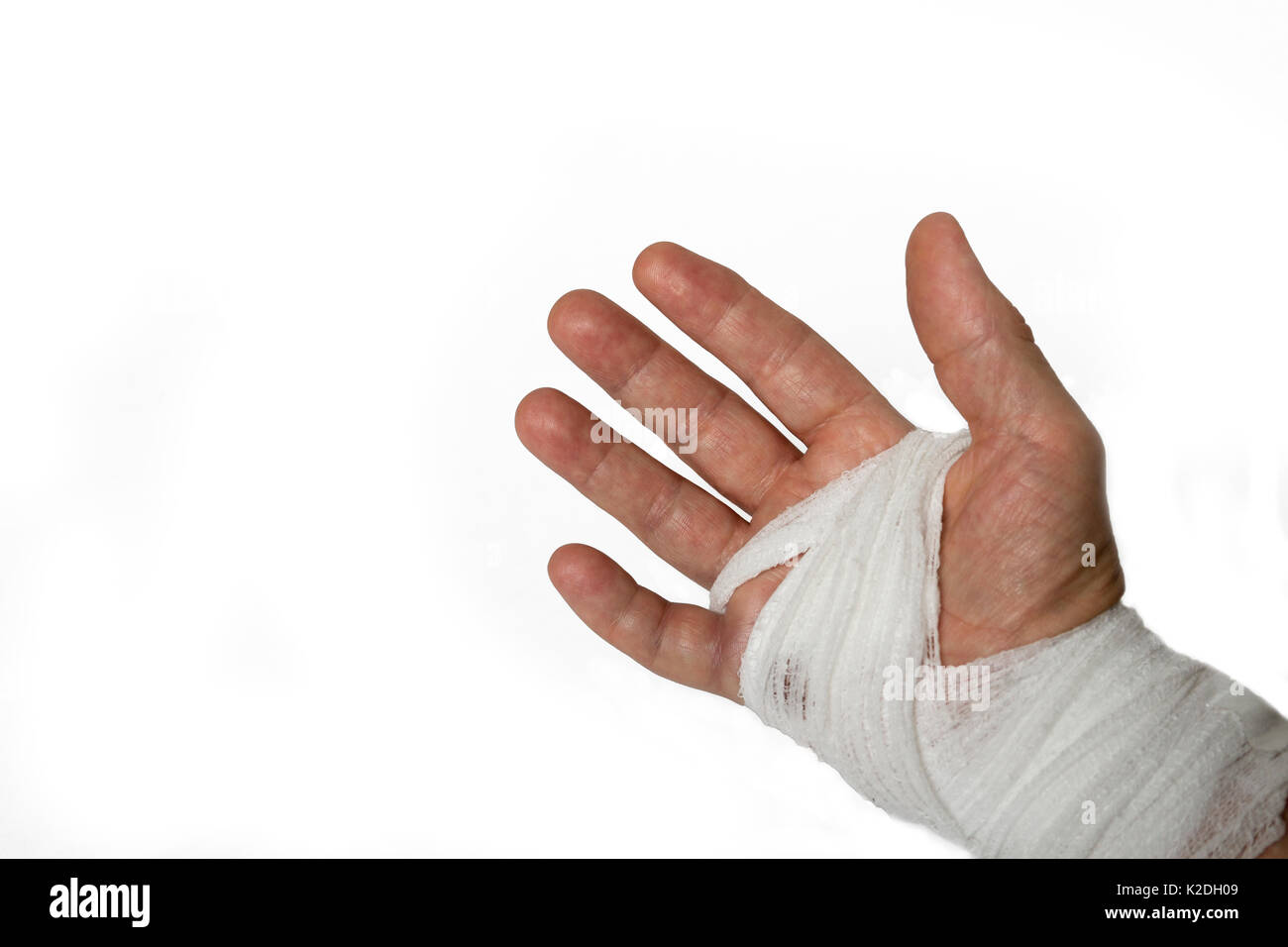 Hand surgery joint hi-res stock photography and images - Alamy