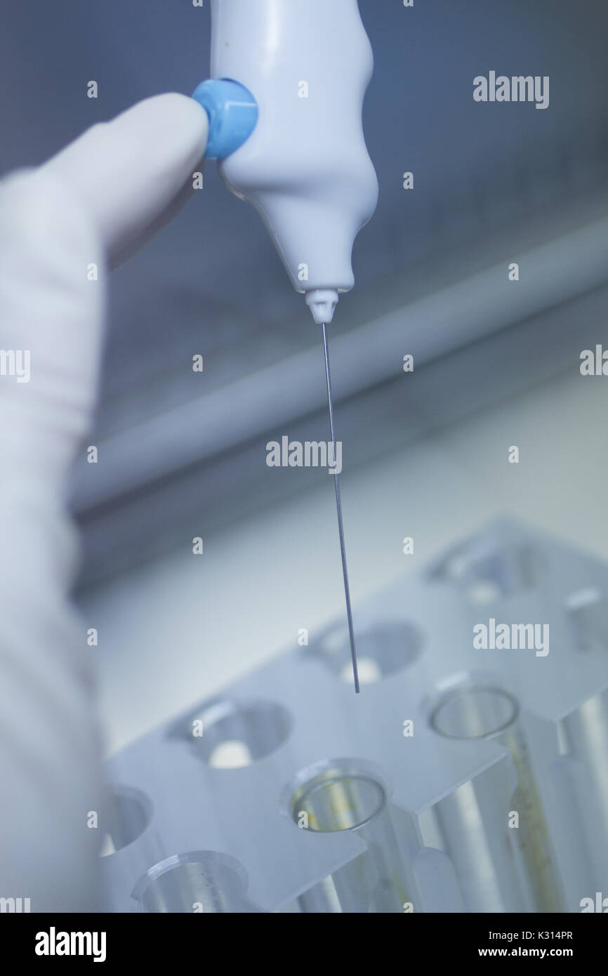 Platelet rich plasma PRP laboratory clinical preparation for medical ...