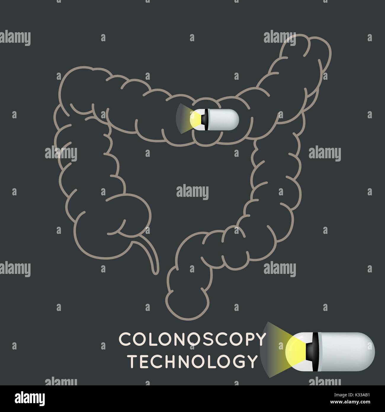 Large intestine endoscope hi-res stock photography and images - Alamy