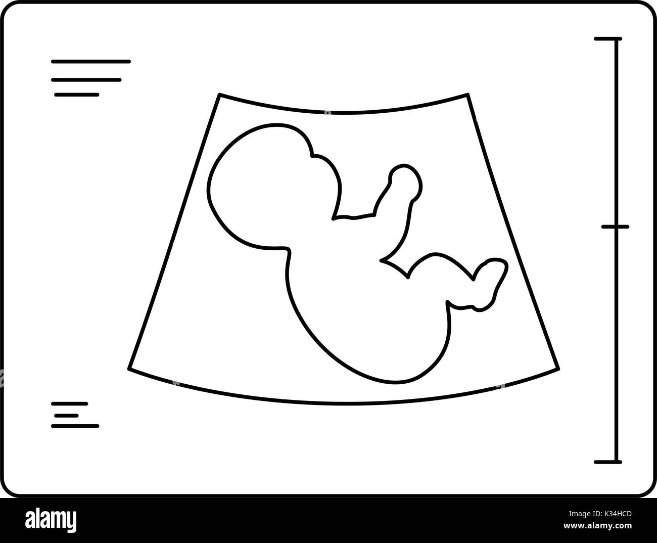 baby Ultrasound isolated icon vector illustration design Stock Vector ...
