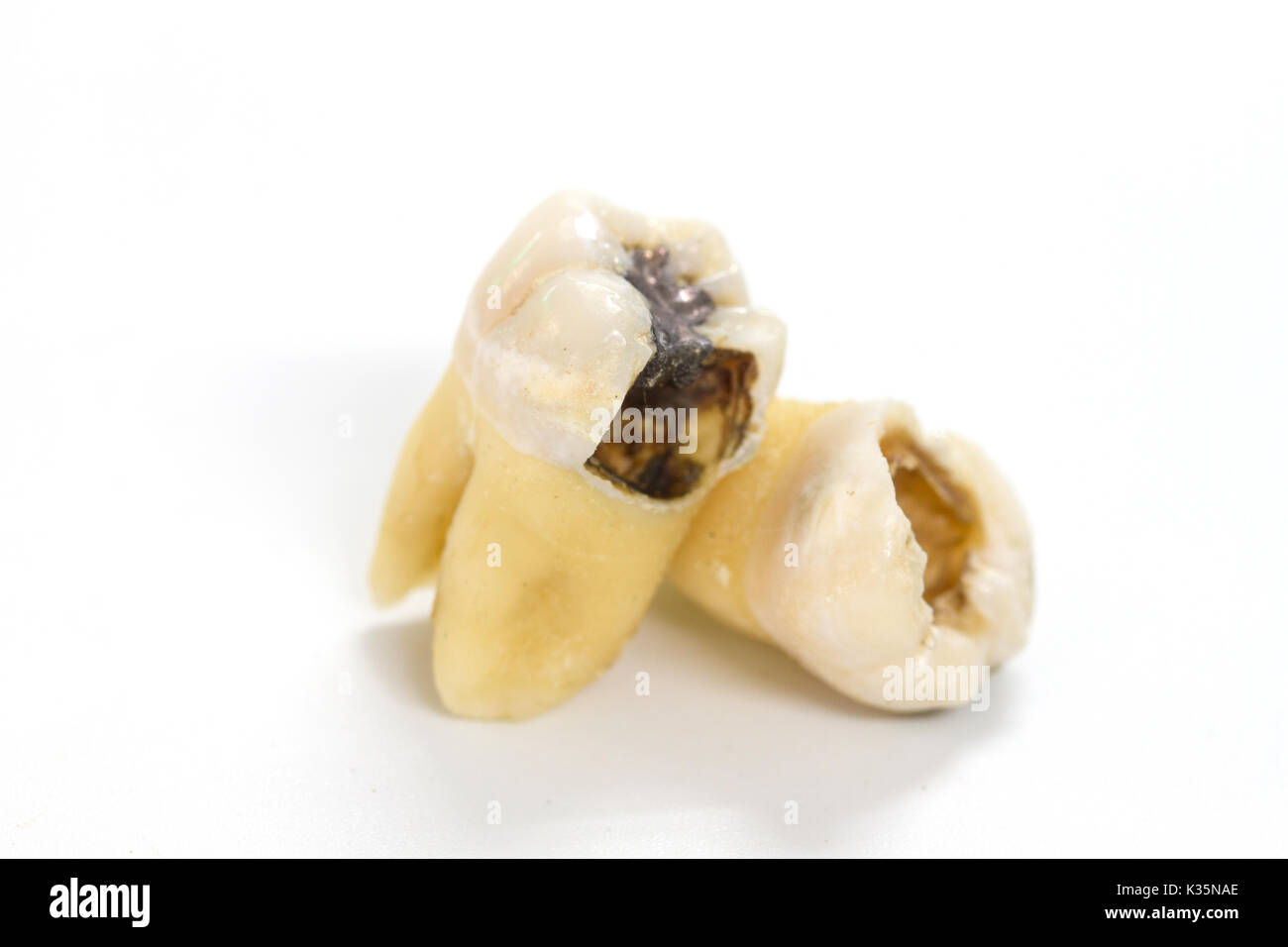Close up decayed tooth on white background Stock Photo - Alamy