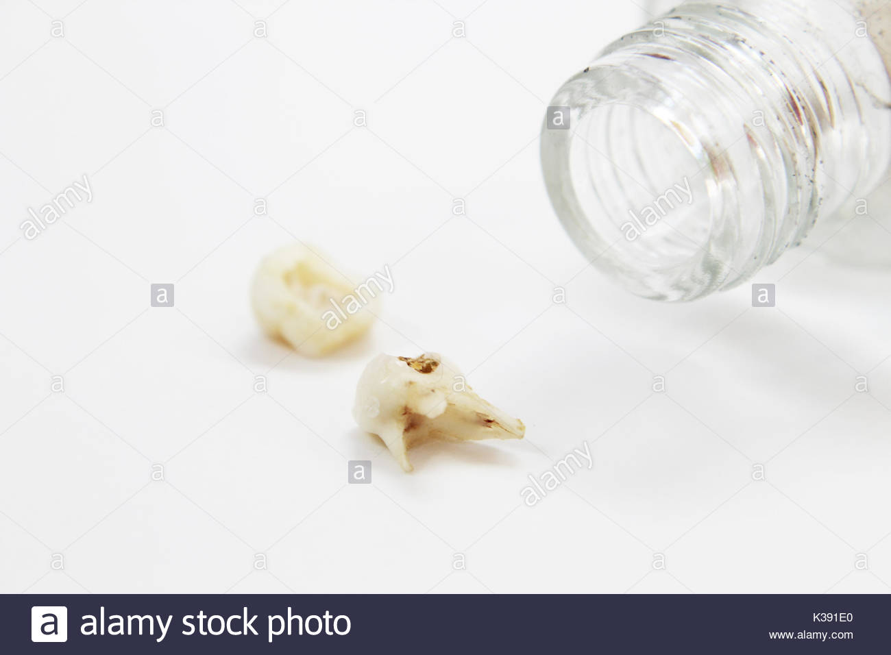 Children Rotten Teeth High Resolution Stock Photography and Images - Alamy