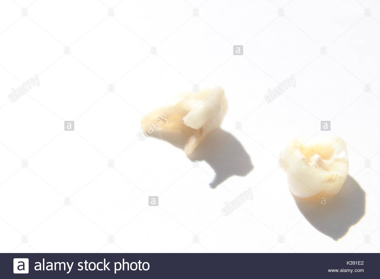 Children Rotten Teeth High Resolution Stock Photography and Images - Alamy