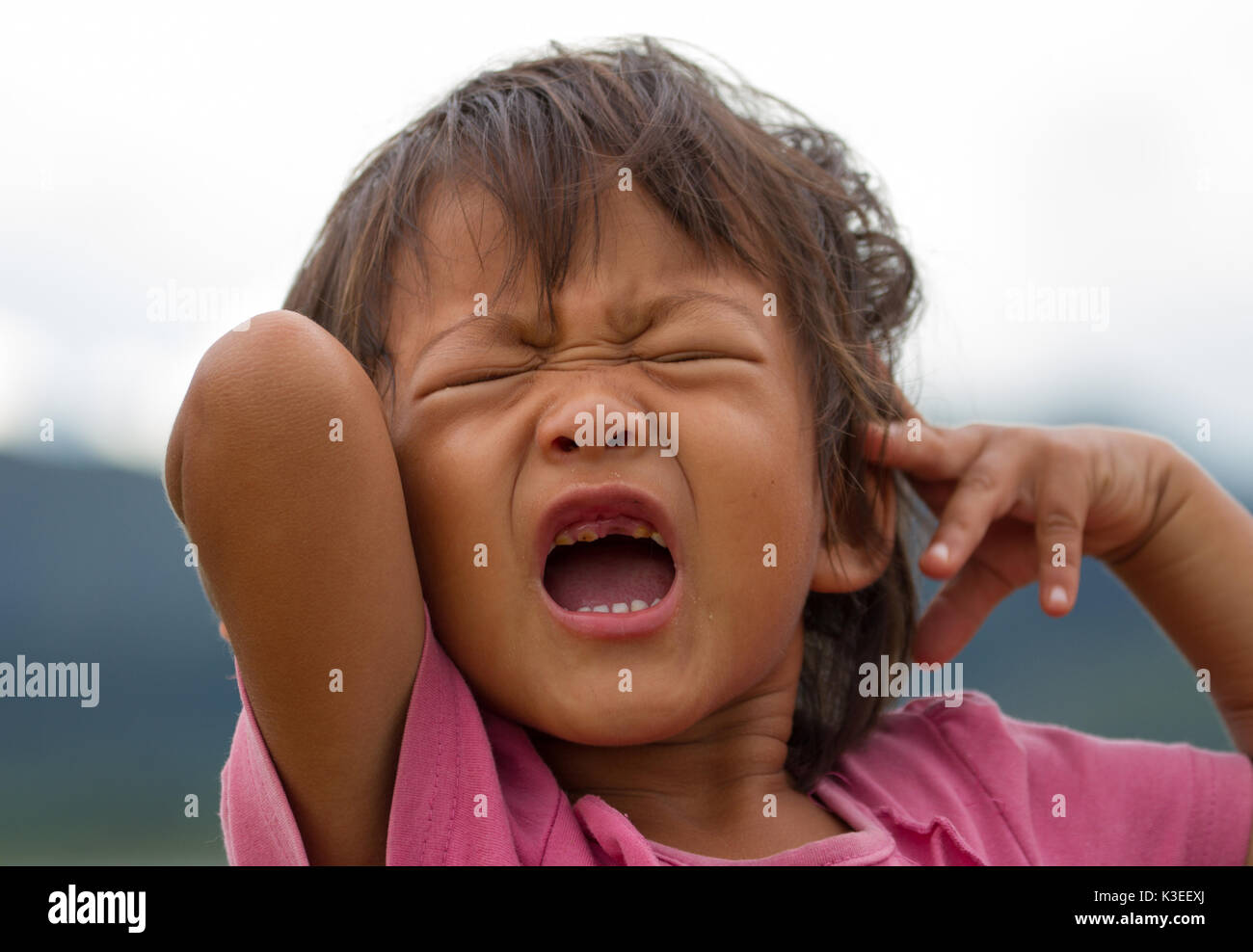 Rotten teeth child hi-res stock photography and images - Alamy