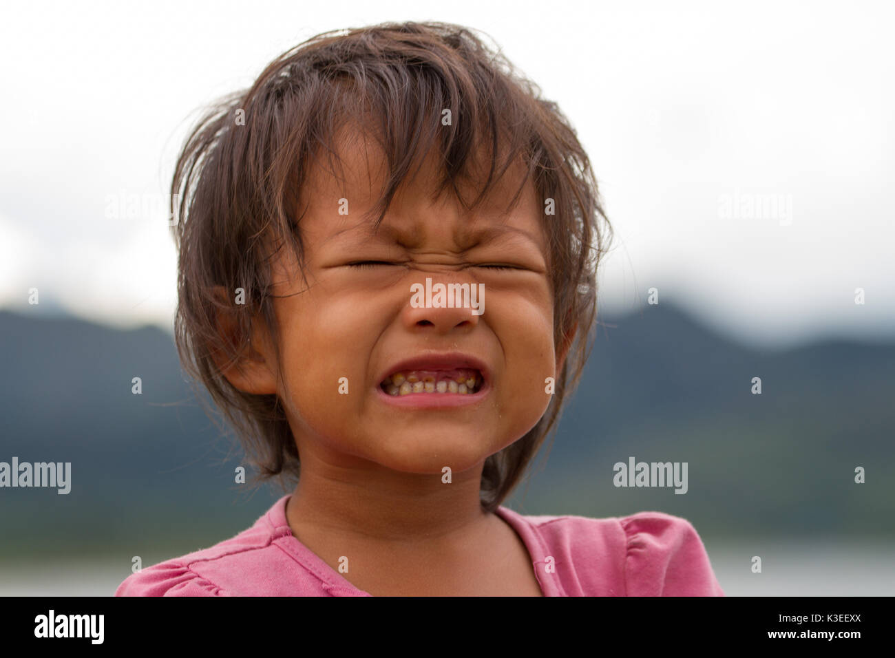 Rotten teeth child hi-res stock photography and images - Alamy
