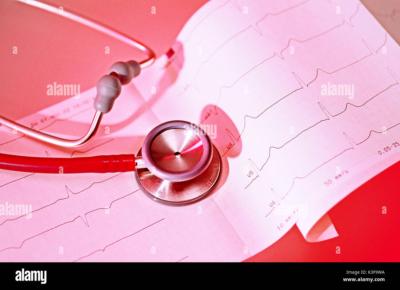 Stethoscope and ECG Stock Photo - Alamy