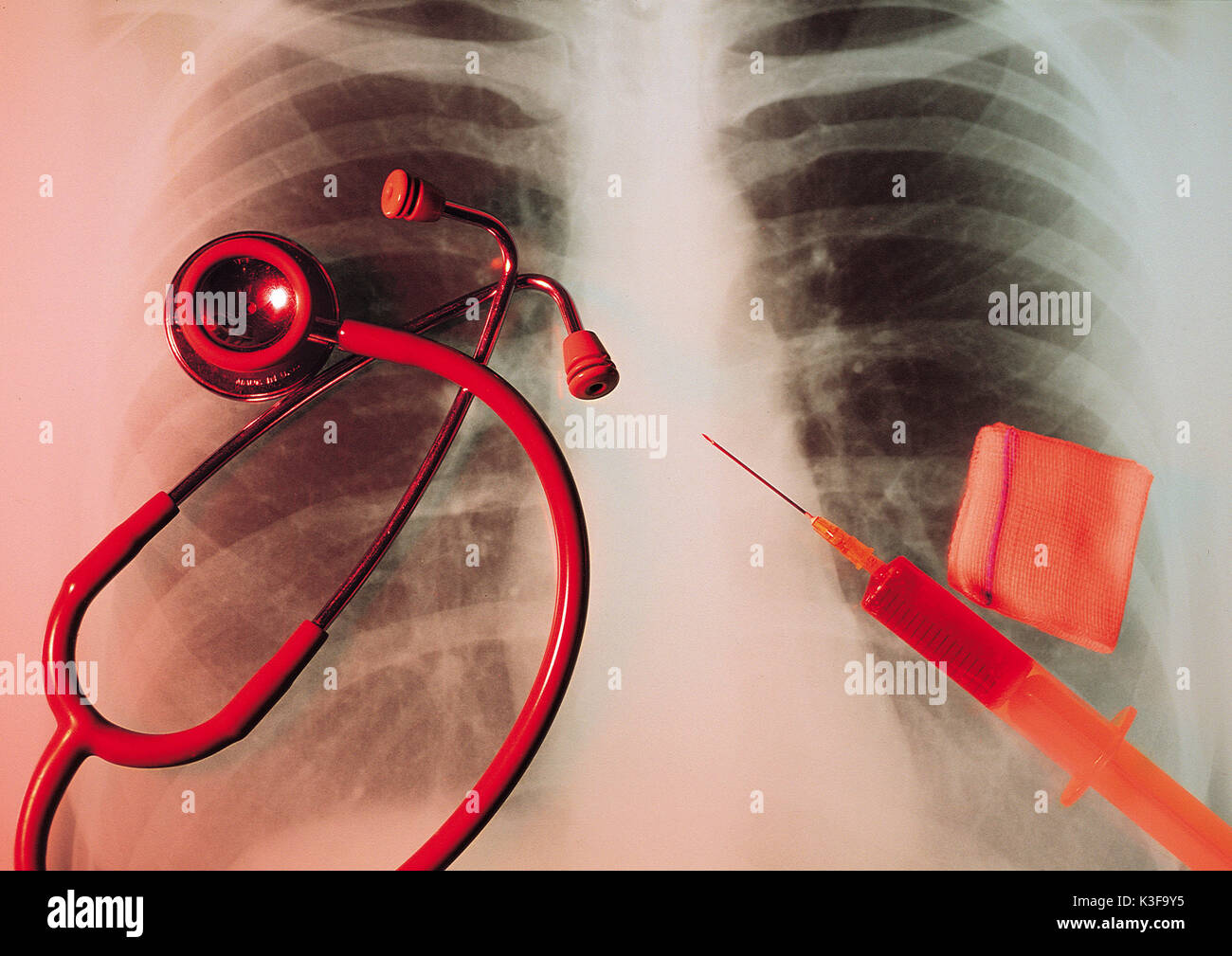 radiograph close doctor's instruments Stock Photo - Alamy