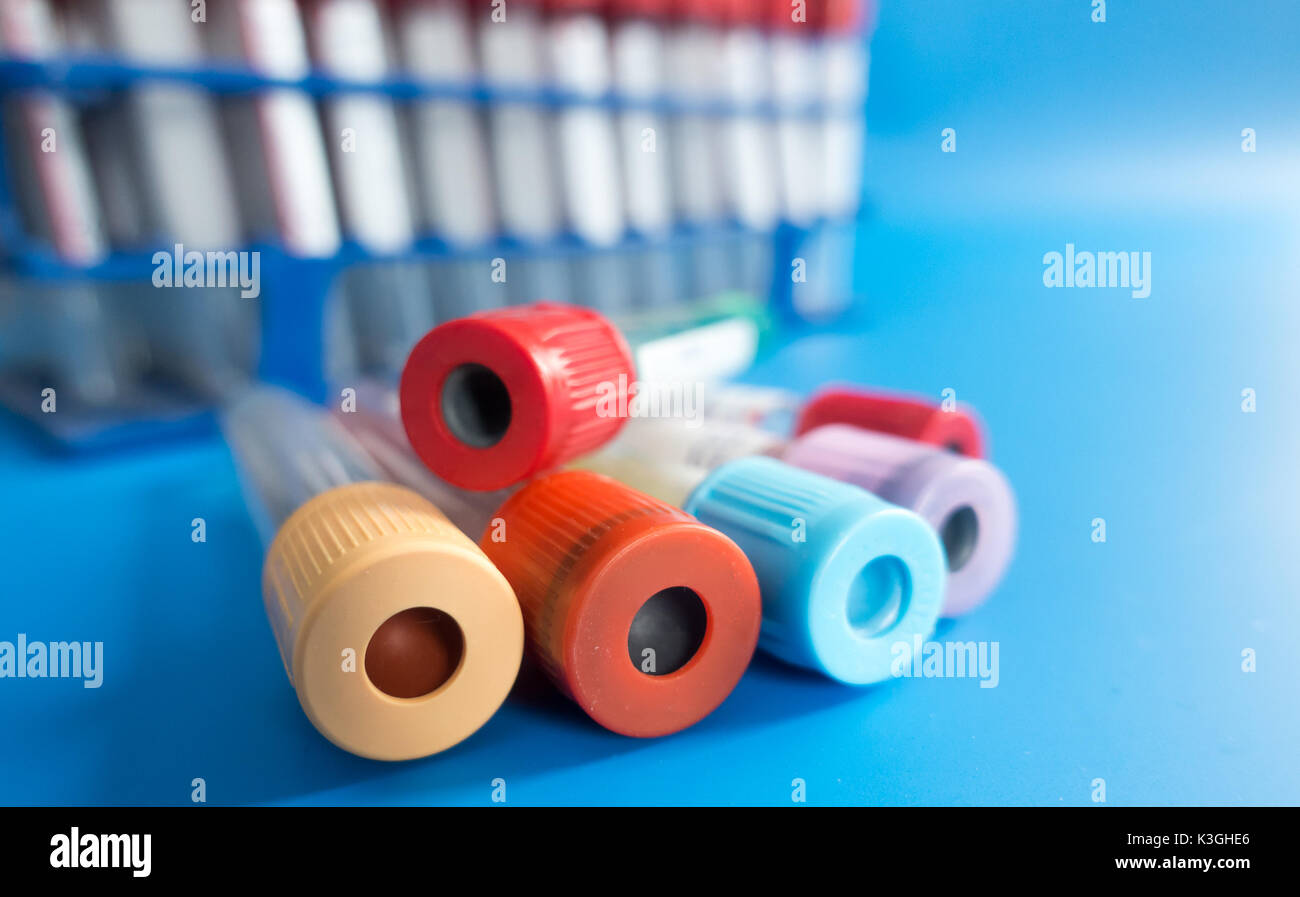Blood sample in test tubes Stock Photo - Alamy
