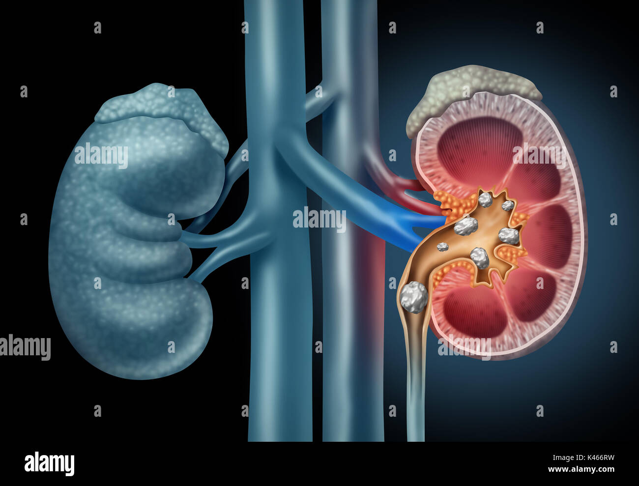 Human kidney hi-res stock photography and images - Alamy