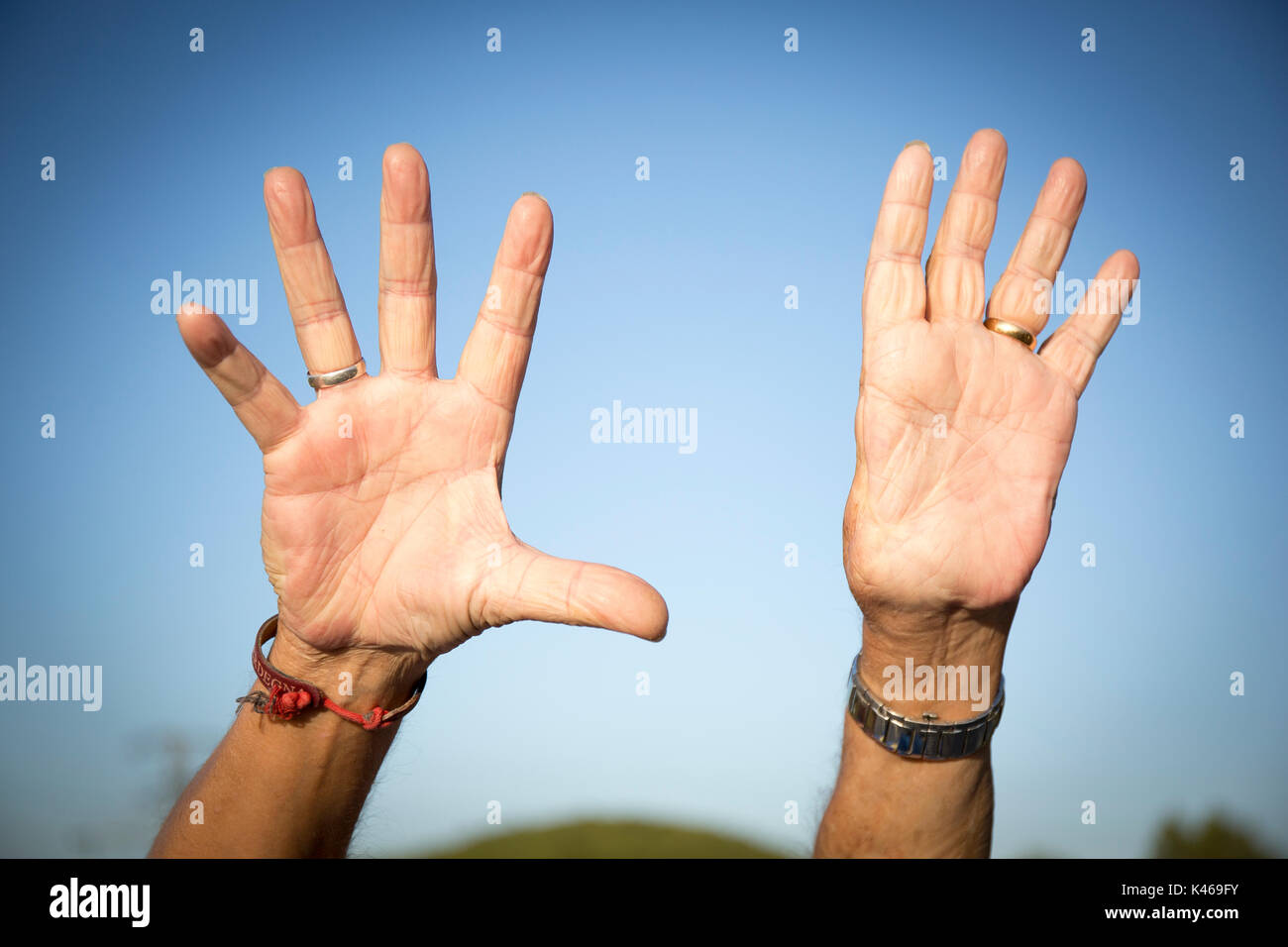 Man with only nine fingers Stock Photo - Alamy