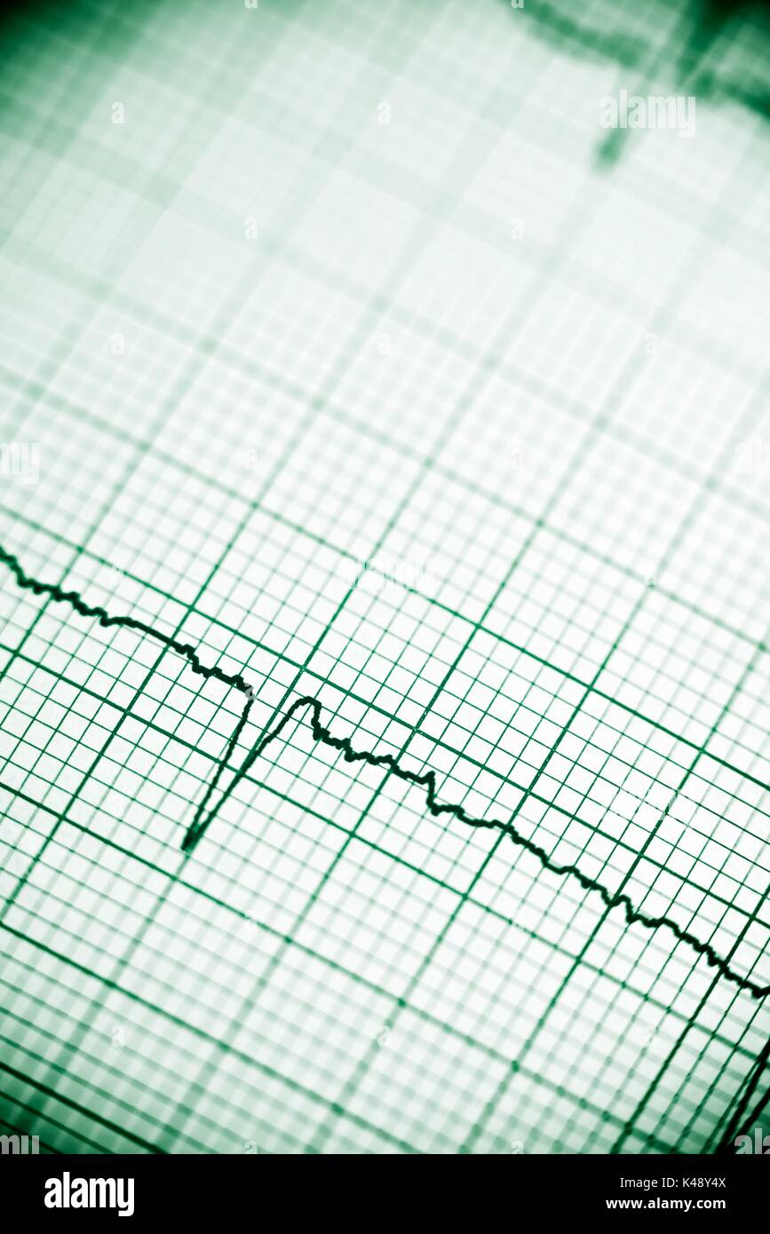 Close up of an electrocardiogram in paper form Stock Photo - Alamy