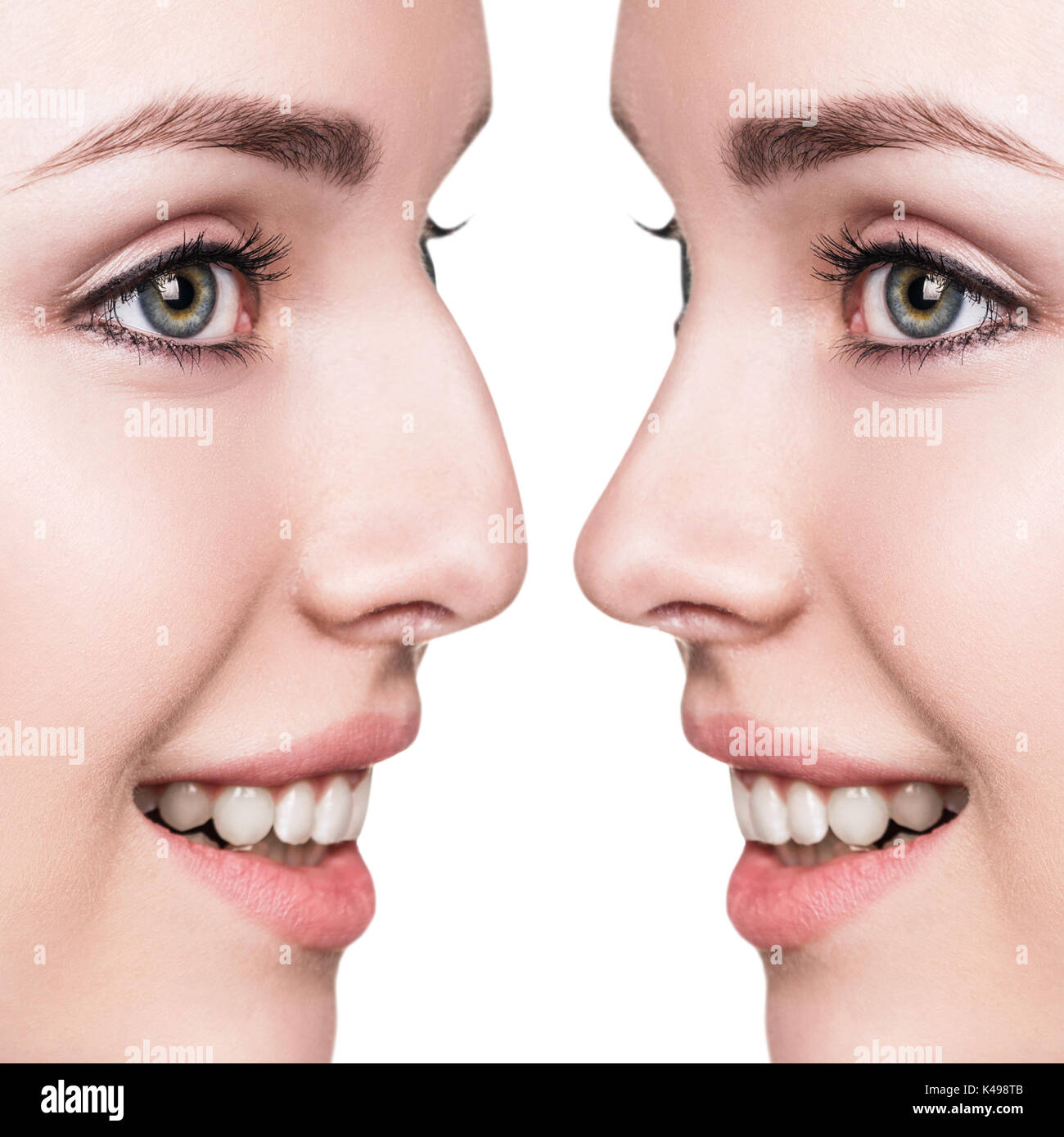 Female nose before and after cosmetic surgery Stock Photo - Alamy