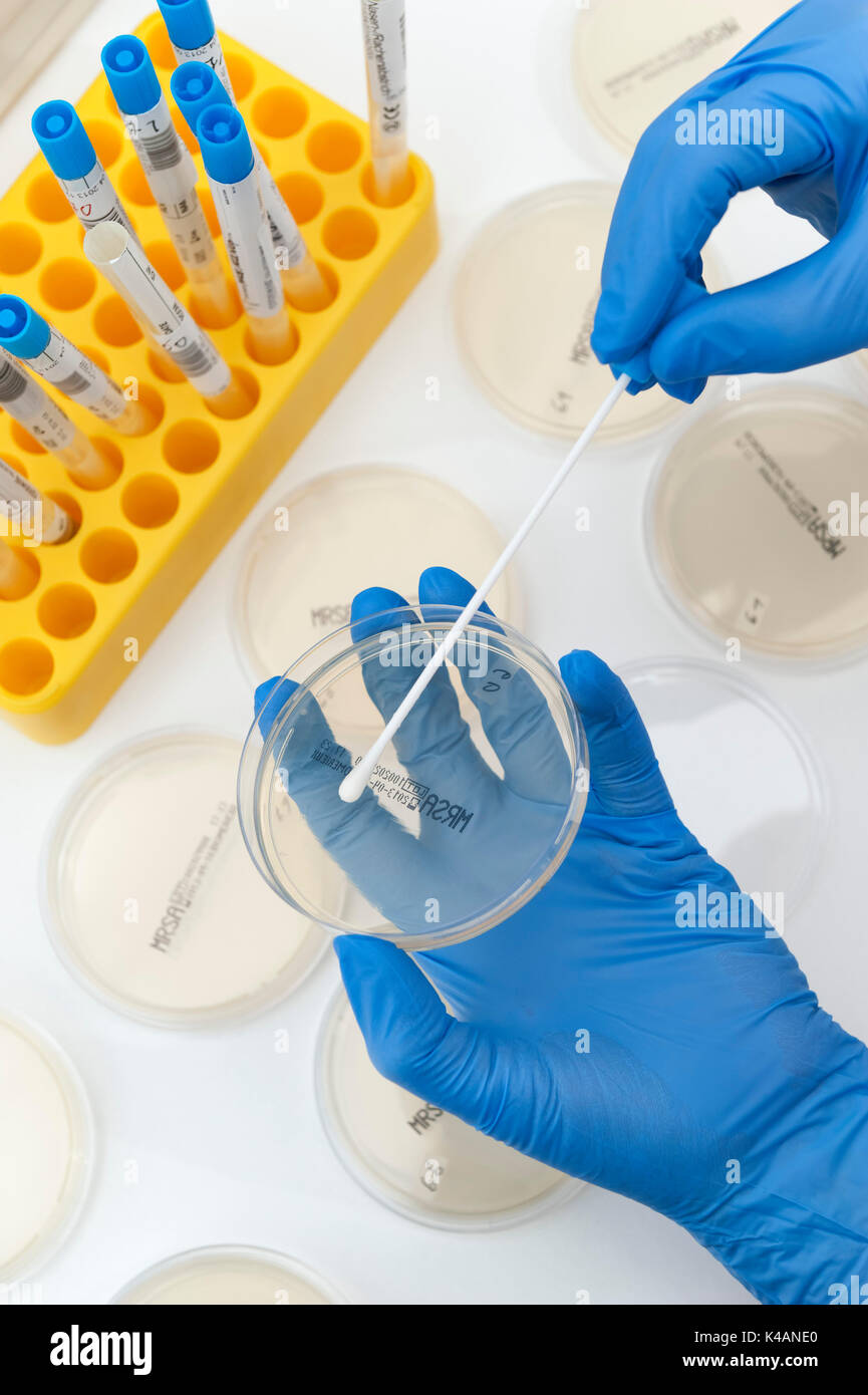 Smear from mucous membranes is cultivated in petri dishes ...