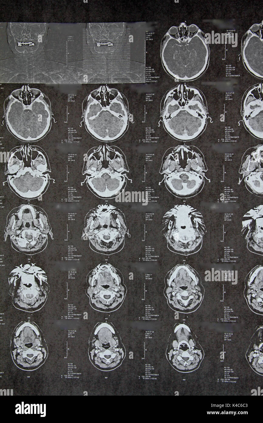 Radiological hi-res stock photography and images - Alamy