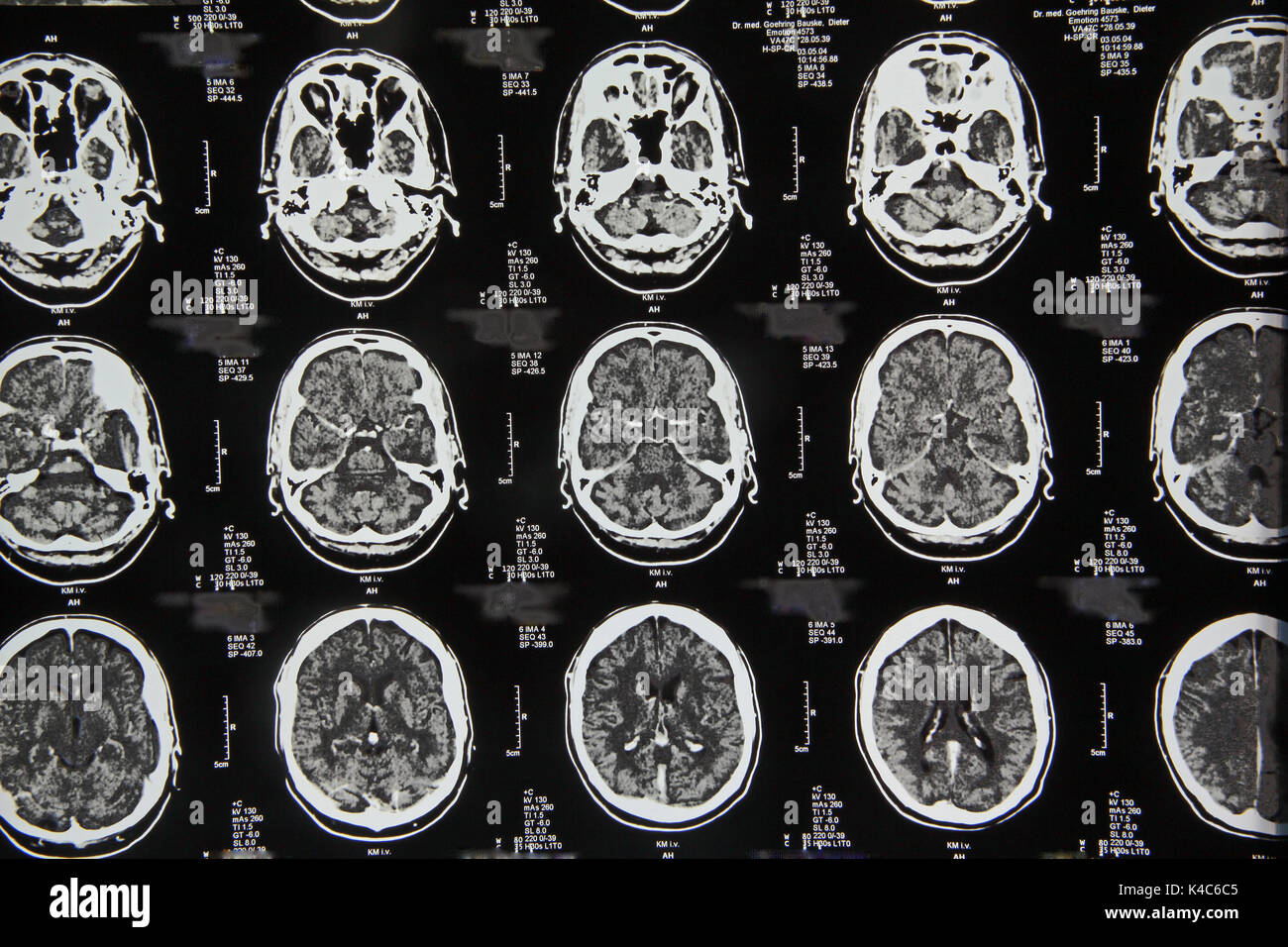 Radiological hi-res stock photography and images - Alamy