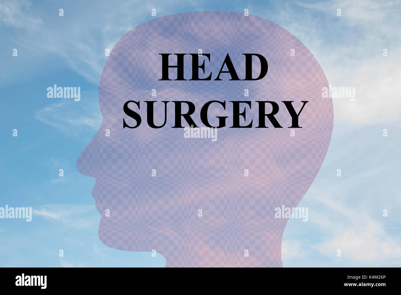 Render illustration of "HEAD SURGERY" title on head silhouette, with ...