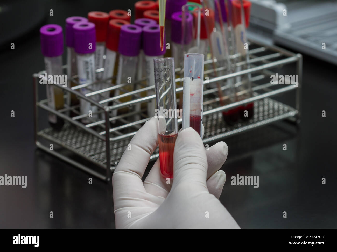 Pipette dropping a sample in test tube,medicine equipment and health ...