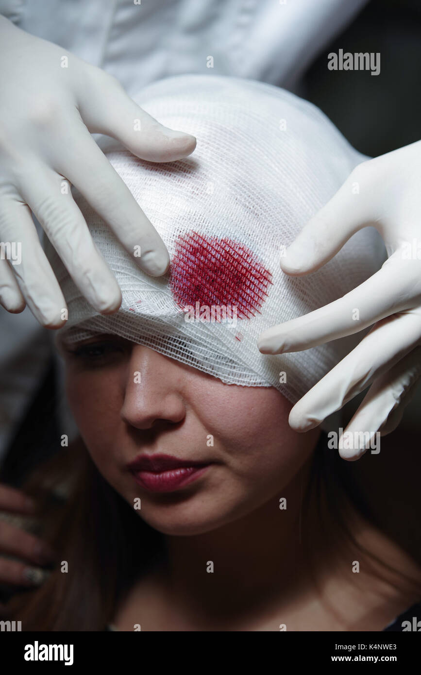 Bruise around eye hi-res stock photography and images - Alamy