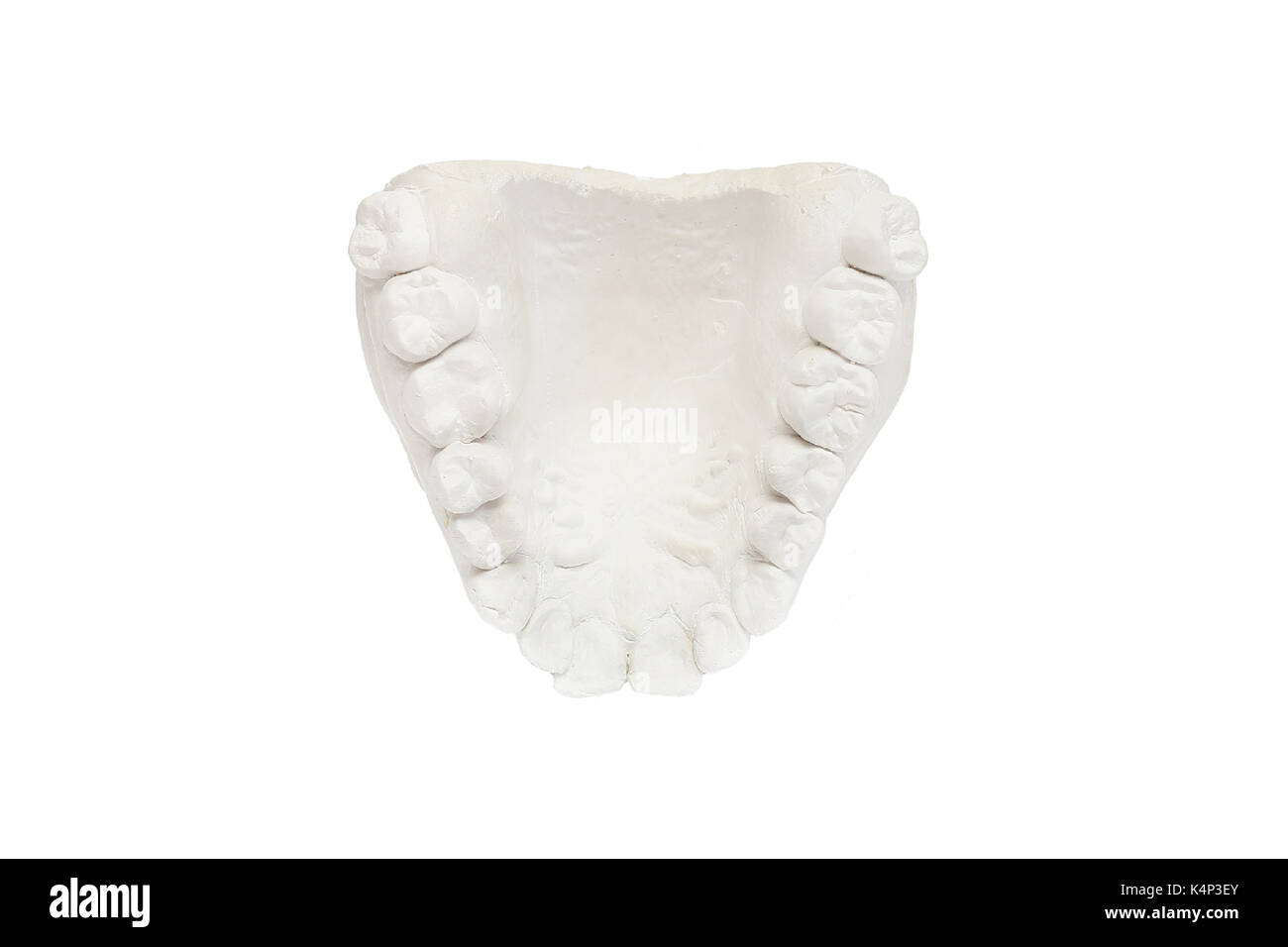 Close-up individual tooth tray Orthodontic dental theme. Invisible ...