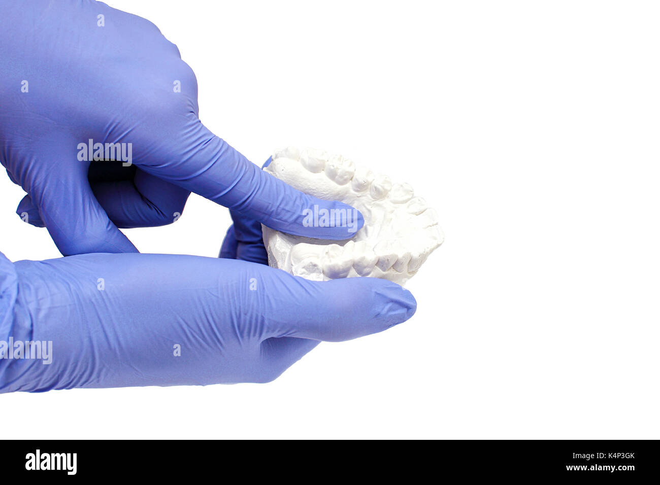 Close-up individual tooth tray Orthodontic dental theme. In hand ...