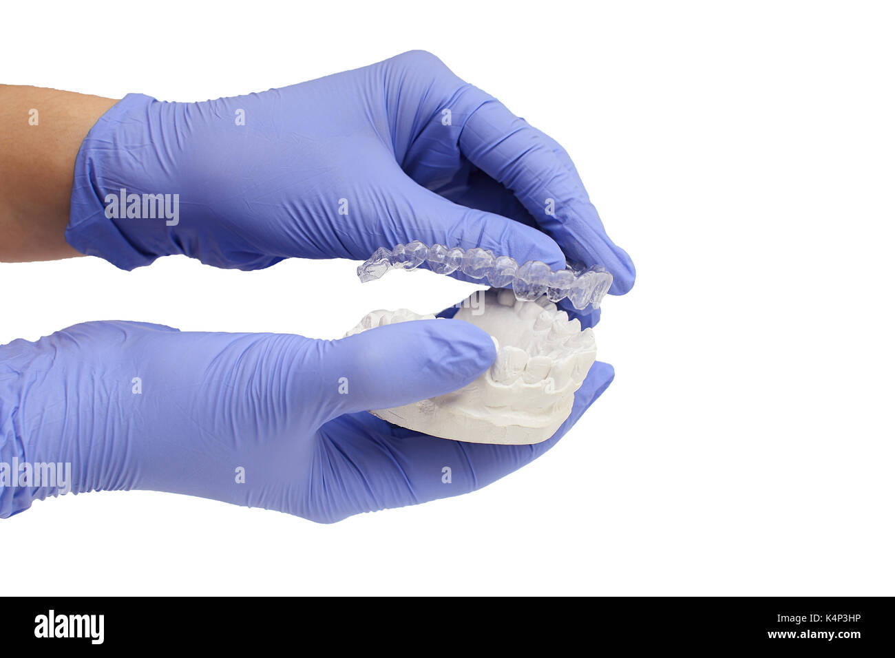 Close-up individual tooth tray Orthodontic dental theme. In hand ...