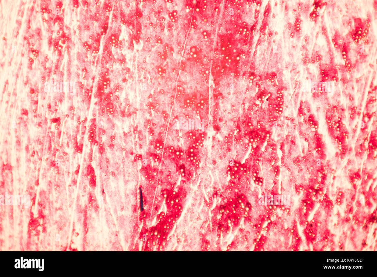 Skin cross section human microscope hi-res stock photography and images ...