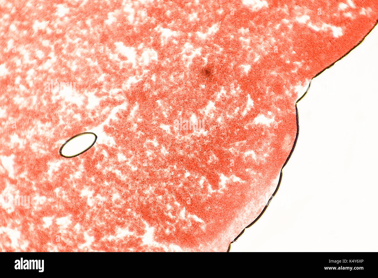 Blood smear High Resolution Stock Photography and Images - Alamy