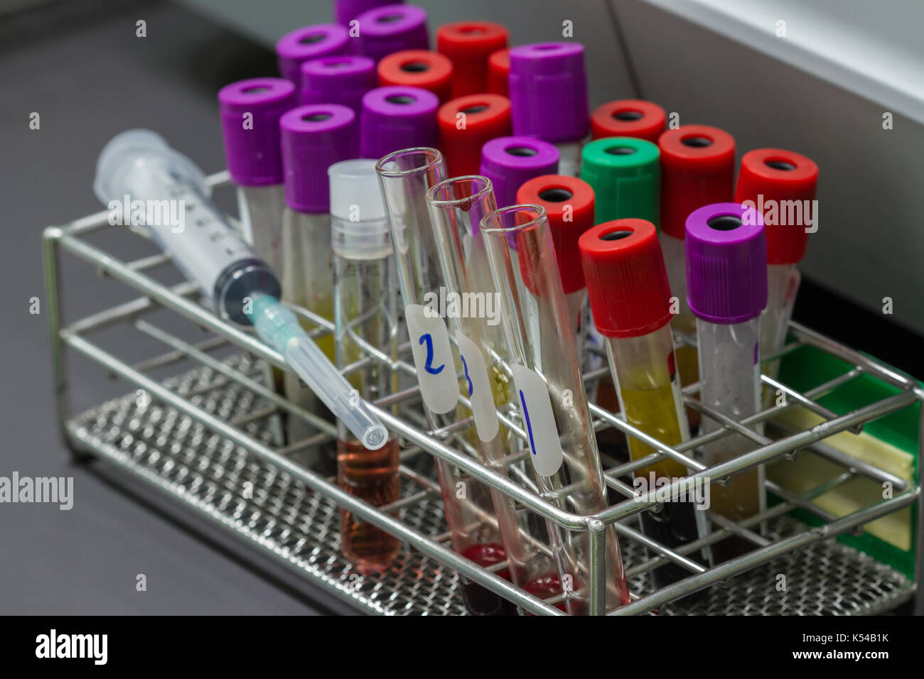 Closeup test tubes with blood for medical and biological analyzes ...