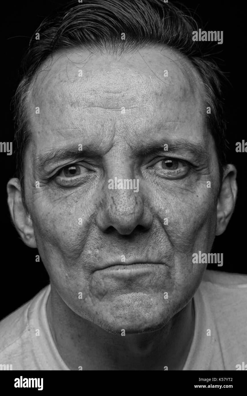 Self pain hi-res stock photography and images - Alamy