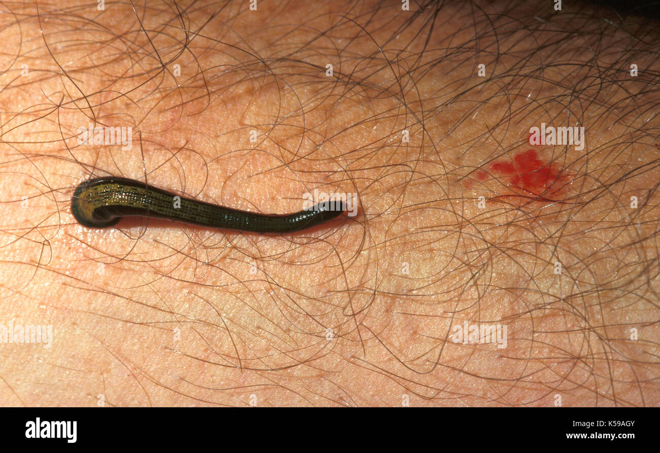 Tiger Leech, Haemadipsa picta, Dannum Valley, Sabah, Borneo, biting ...