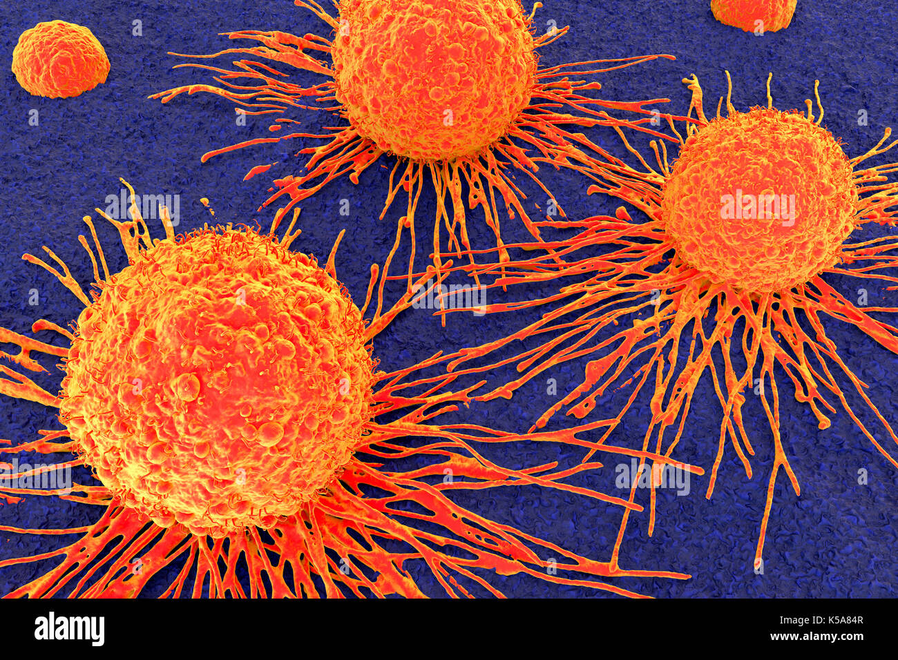 Cancer cells, illustration Stock Photo - Alamy