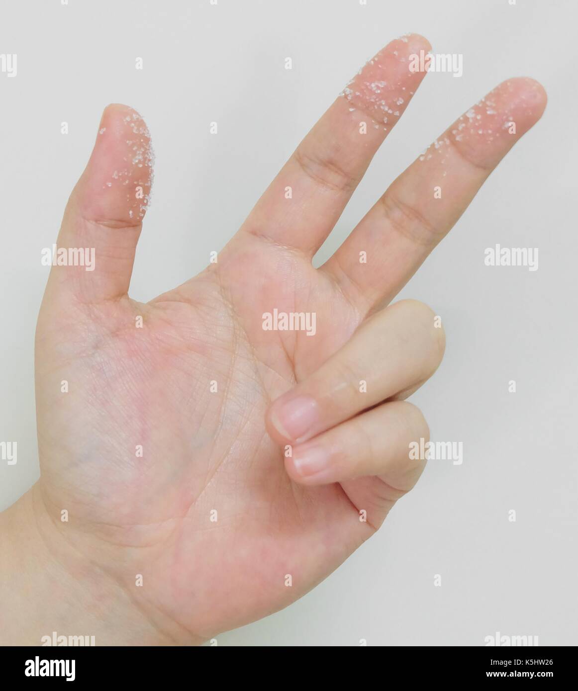 Open Empty Hand Reaches Out with White Sugar on Fingers Against on ...