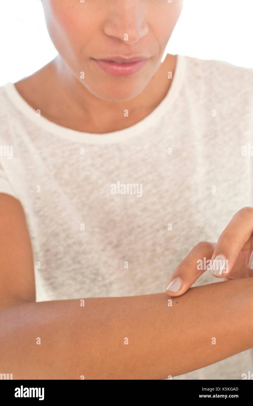 Woman mole arm hi-res stock photography and images - Alamy