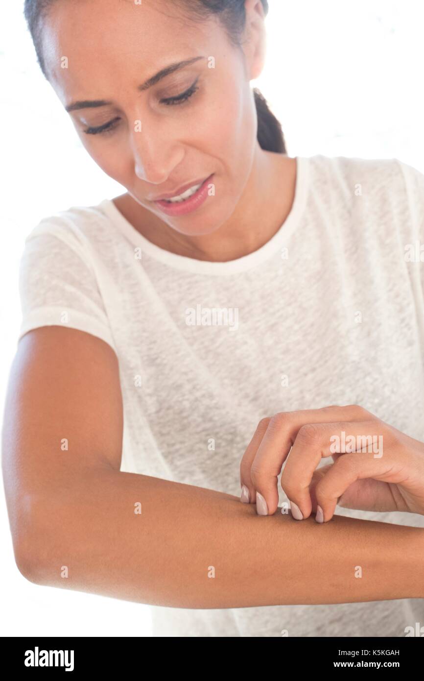 Mid adult woman scratching arm Stock Photo - Alamy