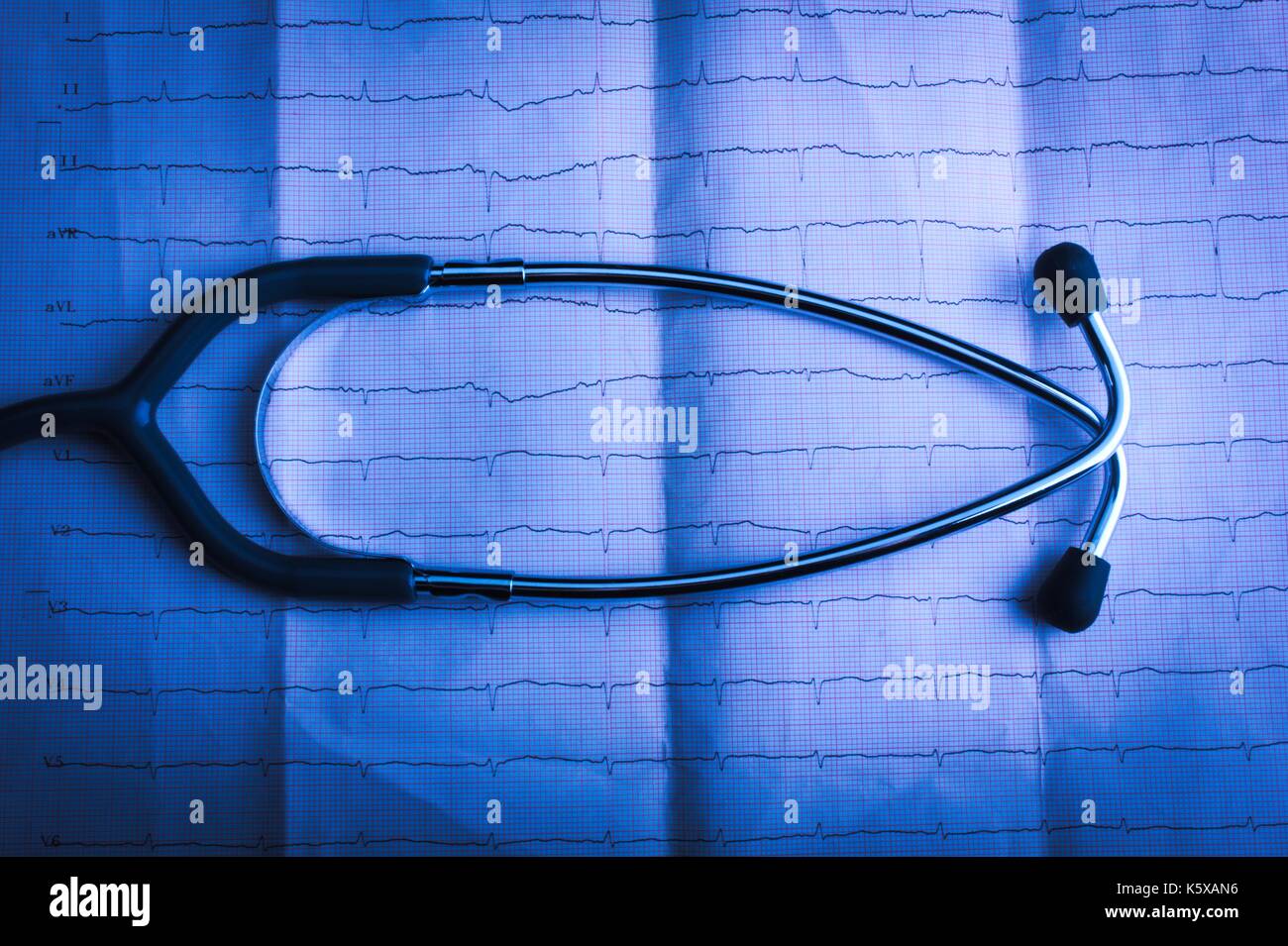 Ecg chart hi-res stock photography and images - Alamy