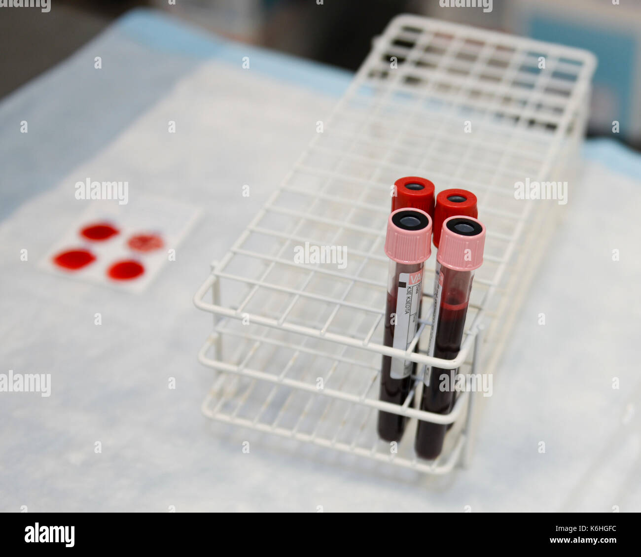 Viles of blood Stock Photo - Alamy
