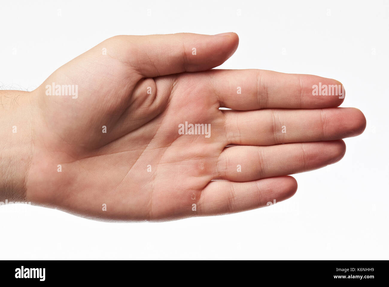 Hand of young woman with callus isolated on white background Stock ...