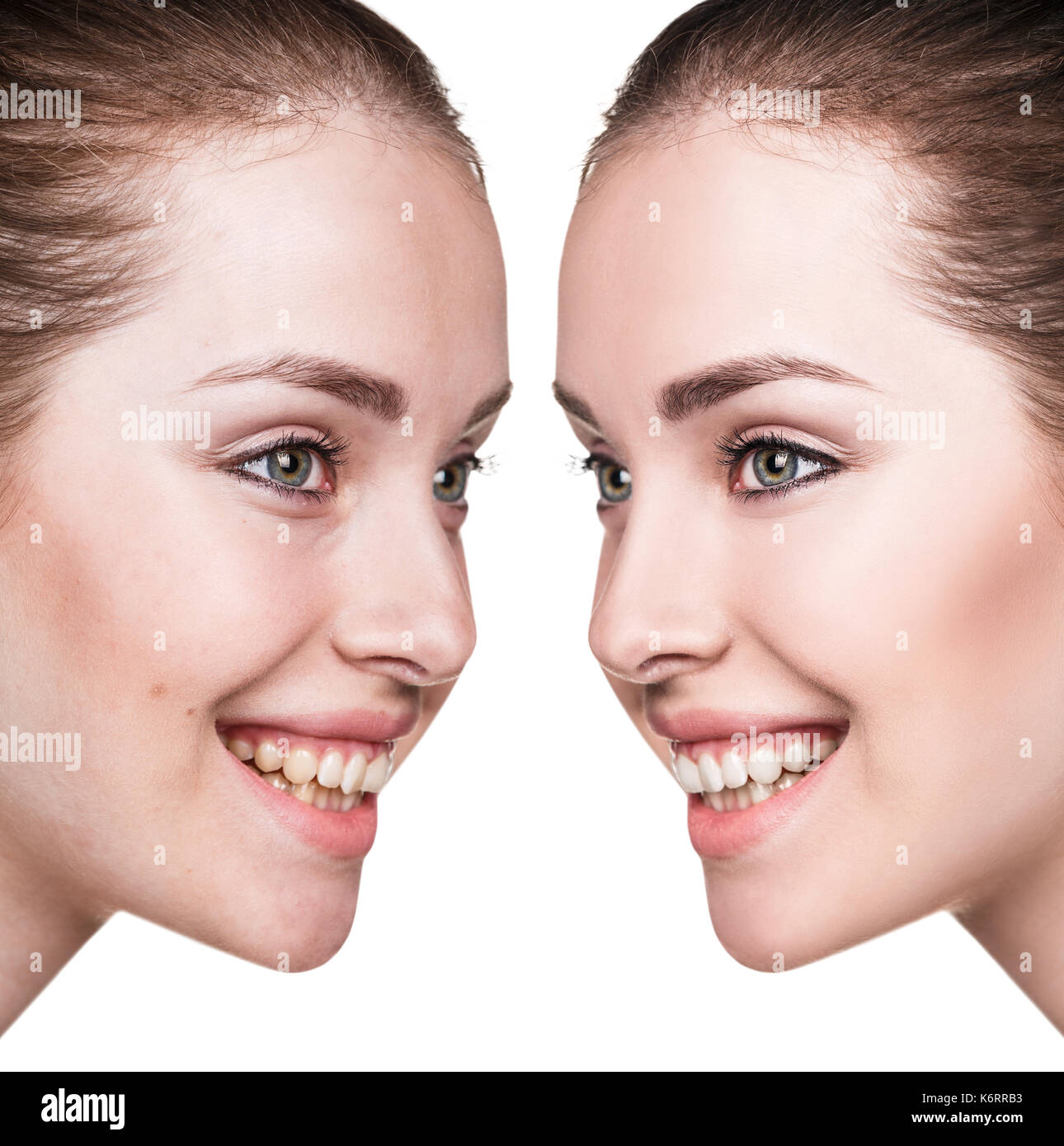 Skin retouching hi-res stock photography and images - Alamy