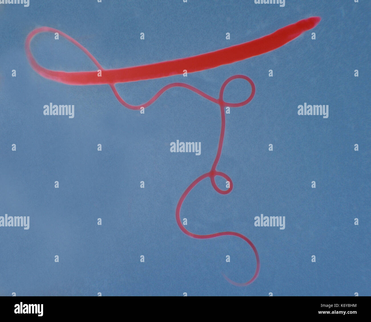 Trichiuris hi-res stock photography and images - Alamy