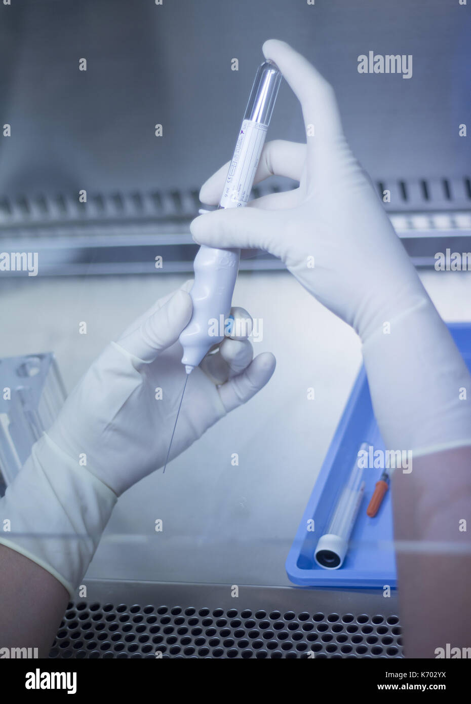 Platelet rich plasma PRP laboratory clinical preparation for medical ...