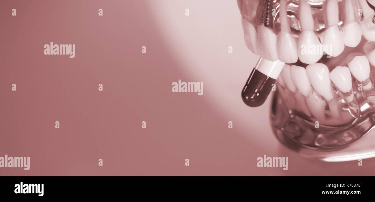 Dental teeth, mouth, gums dentists teaching model showing each tooth ...