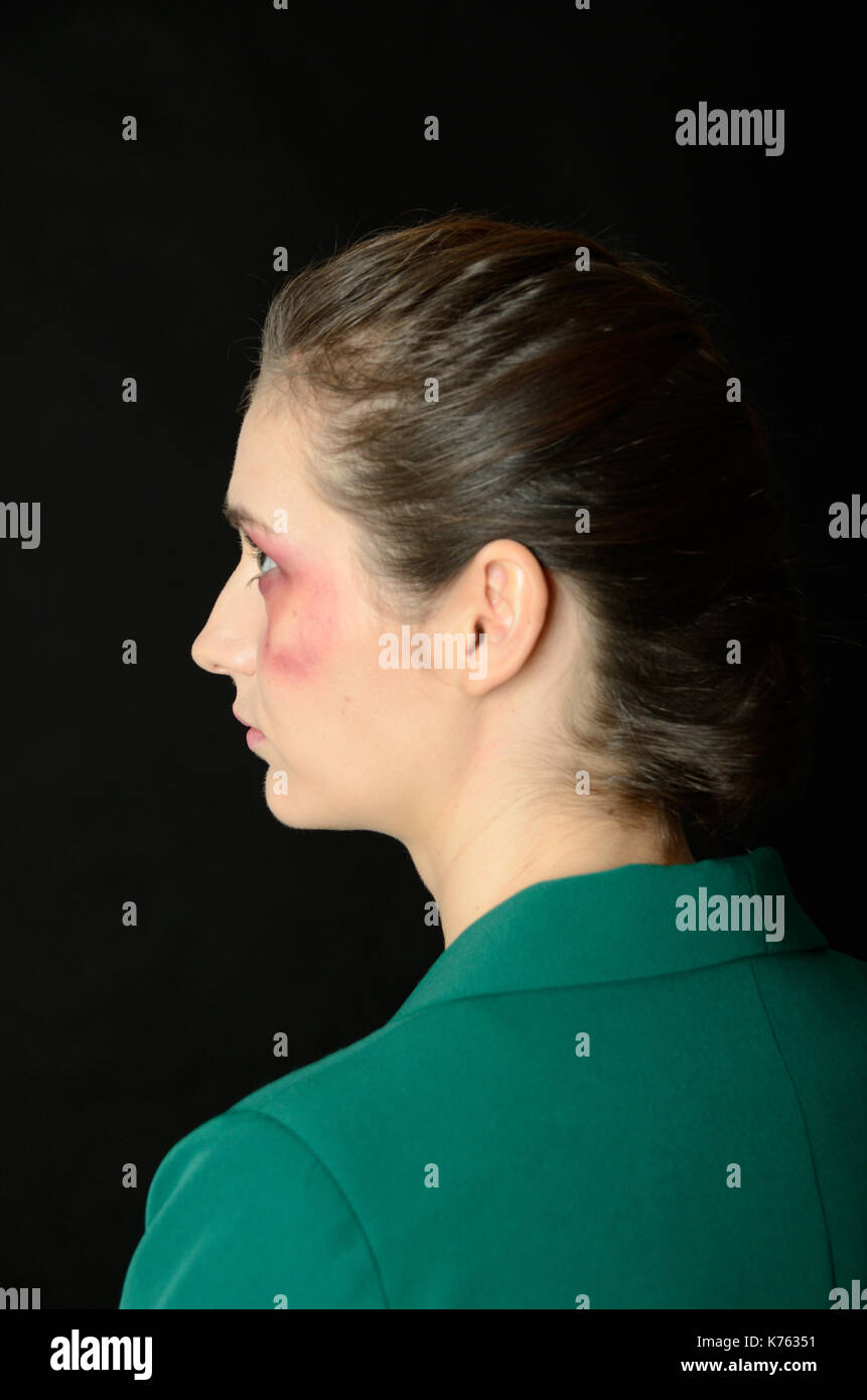 Home violence. Portrait of beaten woman with injuries on face, bleeding ...